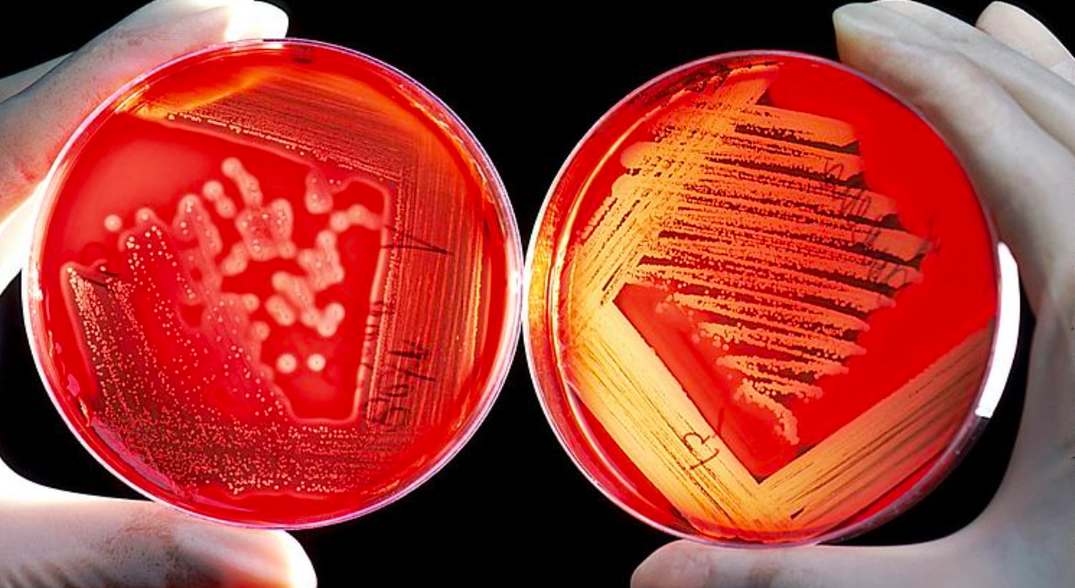 Large Studies Reveal Specific Links Between Depression & Gut Microbes ...