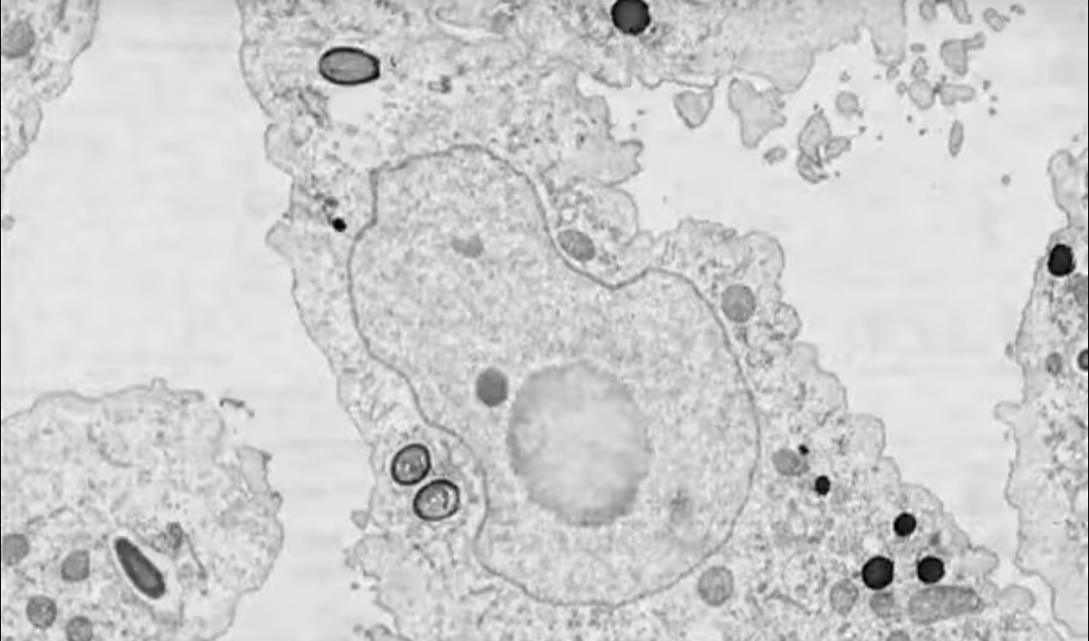 A Very Unusual Virus is Discovered in Brazil | Genetics And Genomics