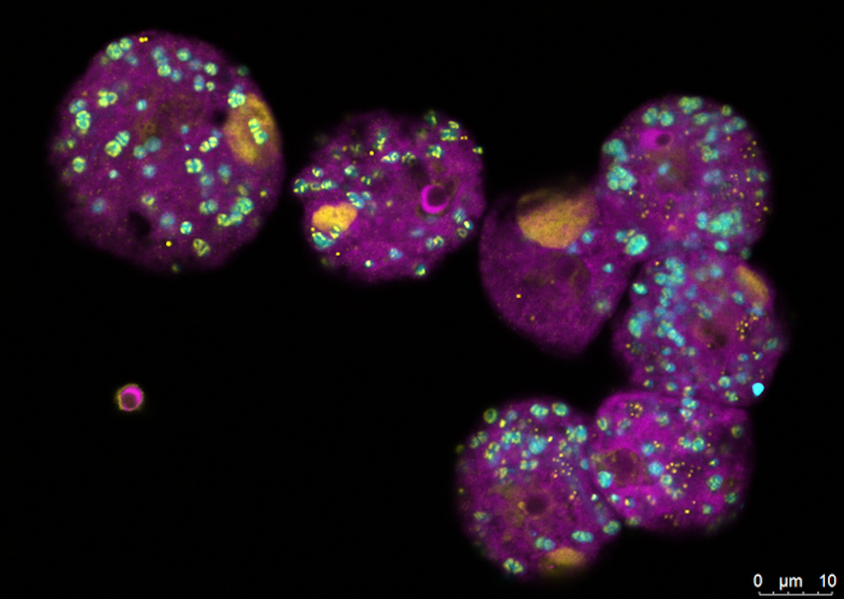 Bacteria Help Defend Amoeba in the Microbial Arms Race | Microbiology