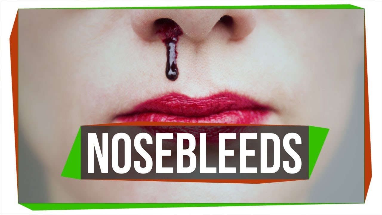 Why are Noses so Prone to Bleeding? | Videos