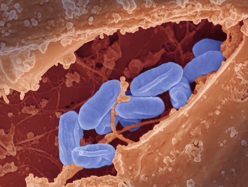 When Worlds Collide - A Pathogen's Inside Connection with Host Cells ...