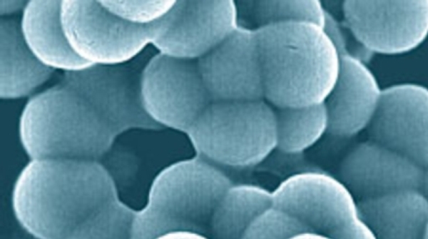 The birth and death of nanobacteria | Microbiology