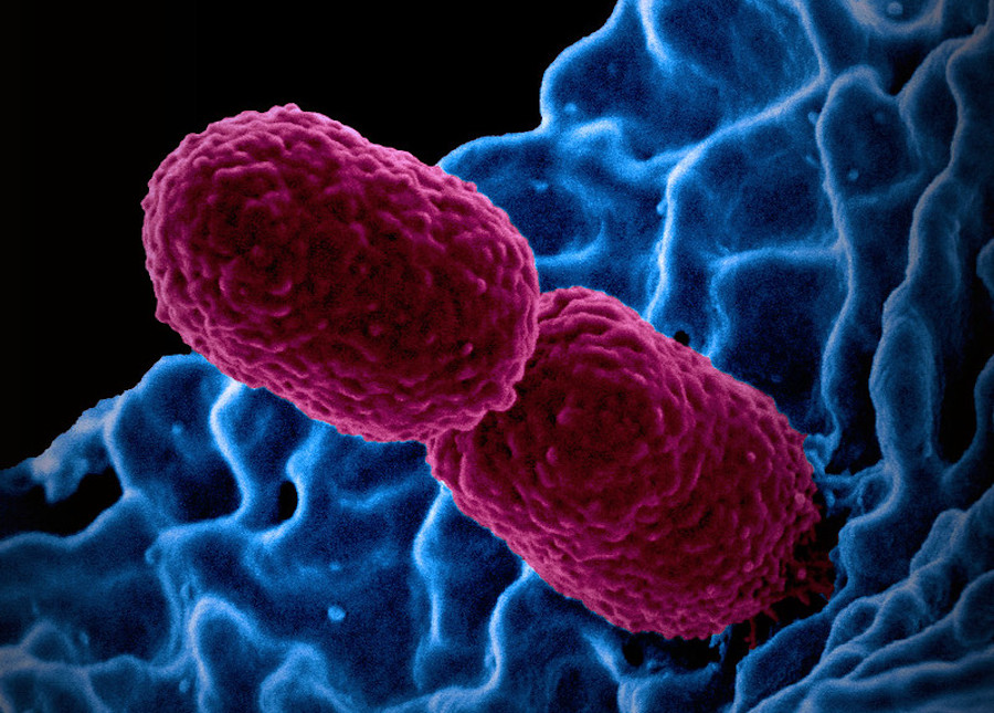 Healthy Bacterial Strains That Can Fight Gut Infections are ID'ed ...