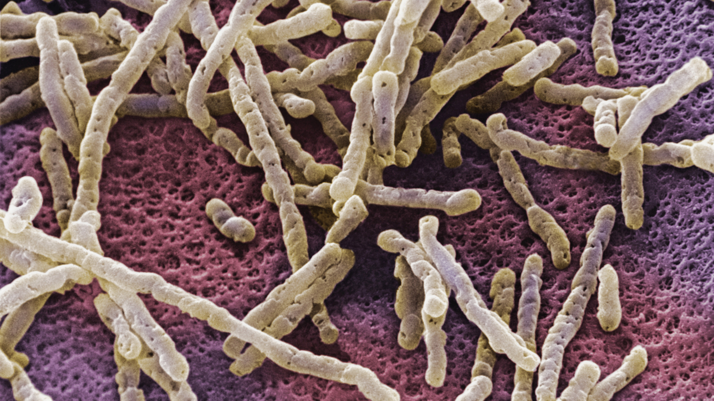 Bezlotoxumab for recurrent C. difficile infections | Microbiology