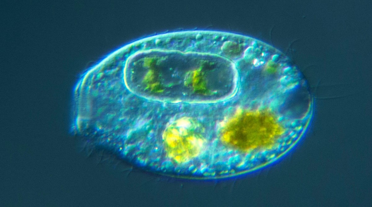 Move Over Bacteria, Make Way for Protists | Microbiology