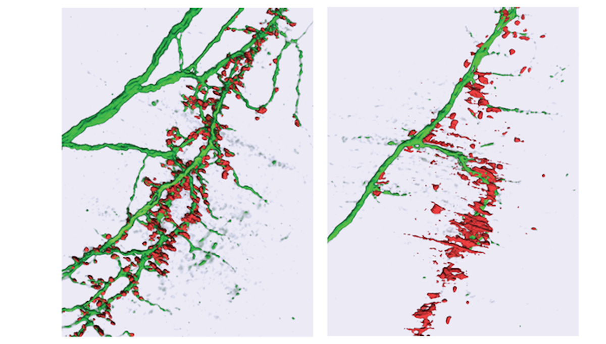 Learning More About How a microRNA is Involved in ALS | Cell And ...