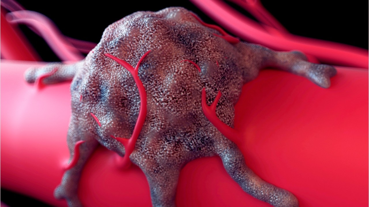 Cancer By The Numbers? | Videos