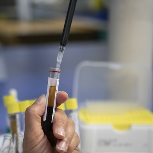 A Blood Test to Diagnose Head Injury | Neuroscience