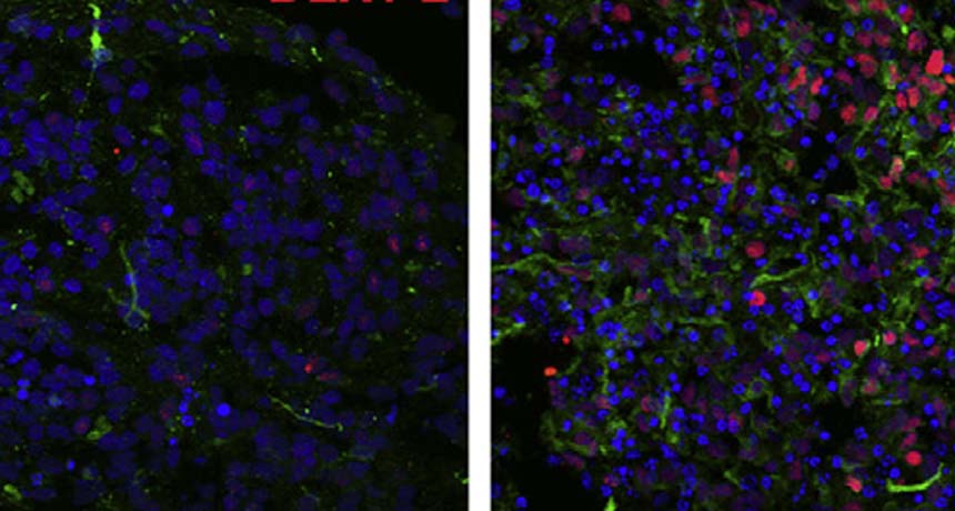 Autistic Brains Differ Biologically | Neuroscience