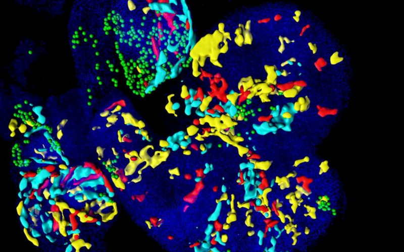 Mesp1 Gene Activity Linked to Congenital Heart Defects | Cardiology