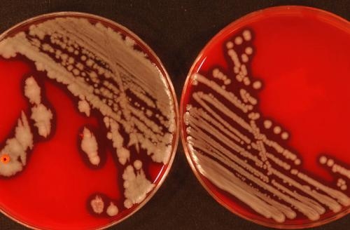 Food poisoning: New detection method for bacteri | Microbiology