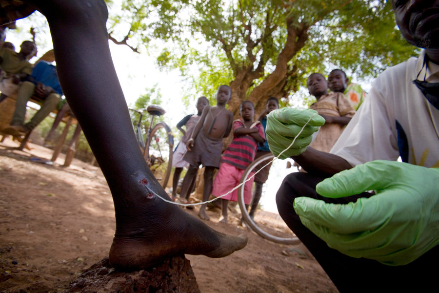 Guinea worm eradication, worth it? | Microbiology