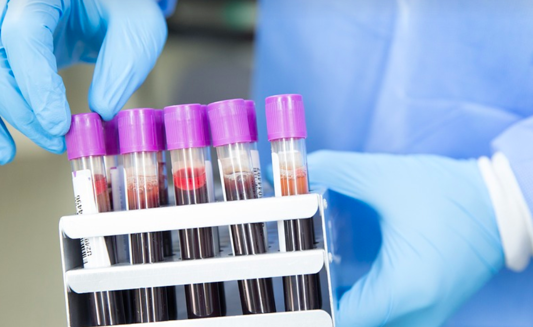 New Test for Rare Neurological Disease Recommended for Kids with ...