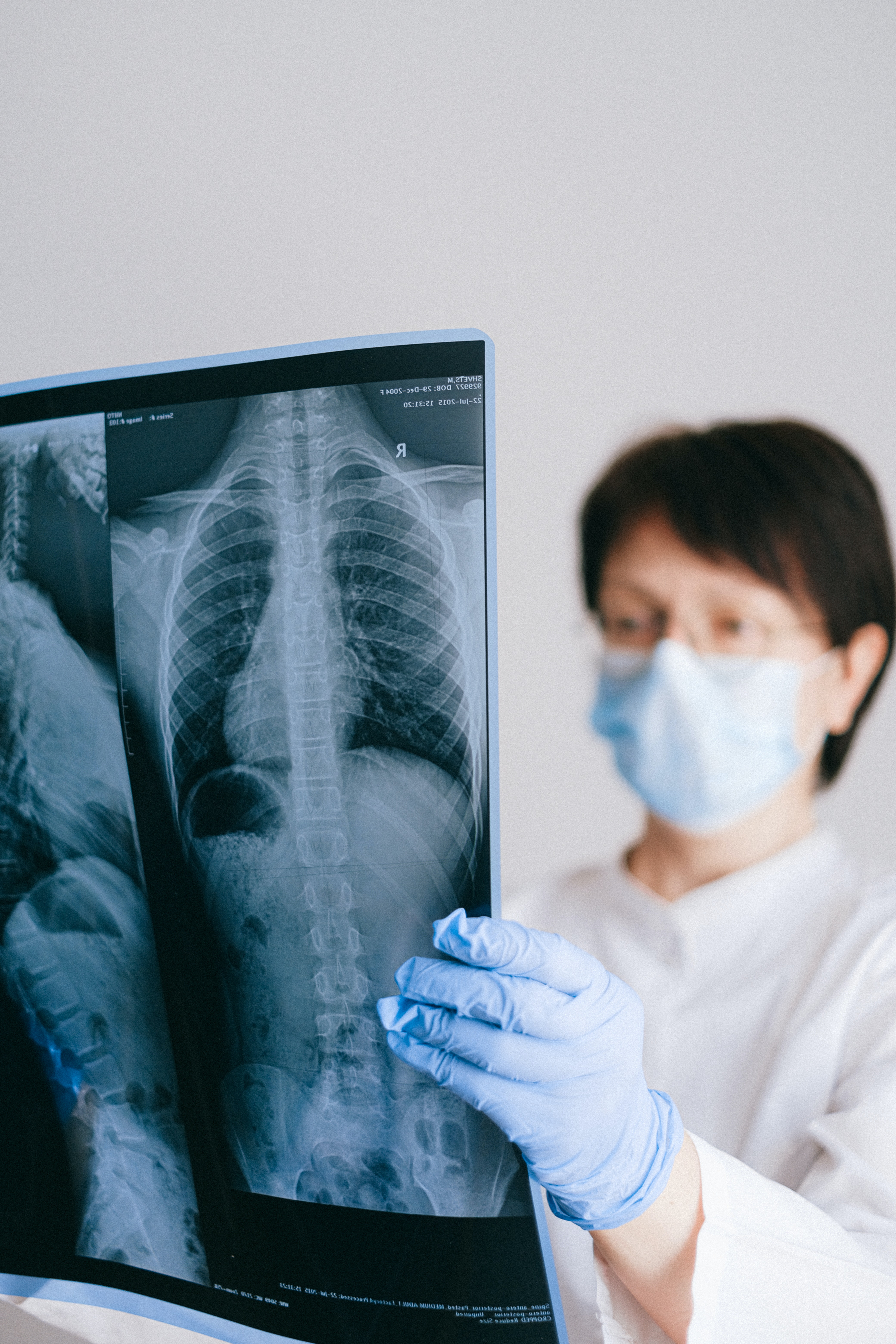 Sonic Hedgehog gene speeds up large-scale bone regeneration | Drug ...