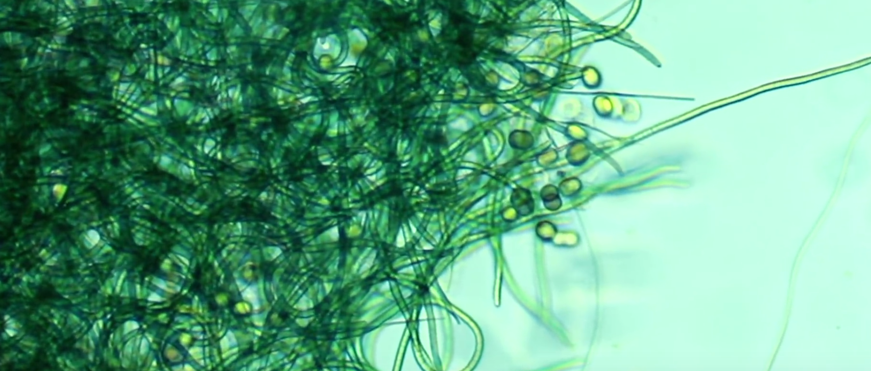 Algae in Space: A Potential Food and Fuel Source? | Space