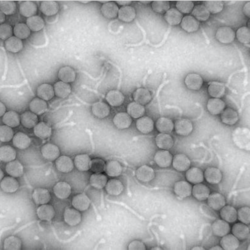 Are Viruses Causing the Inflammation That's a Hallmark of IBD ...