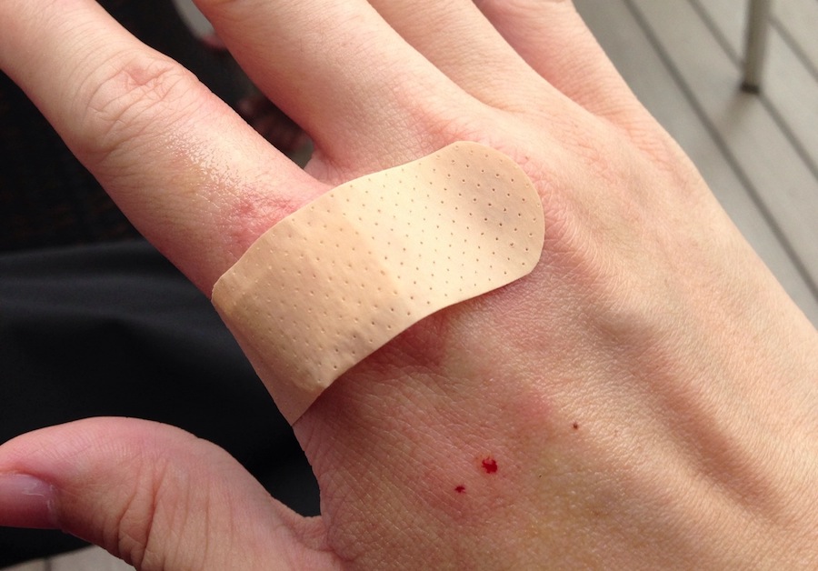 Wounds Sustained at Night Heal More Slowly | Cell And Molecular Biology