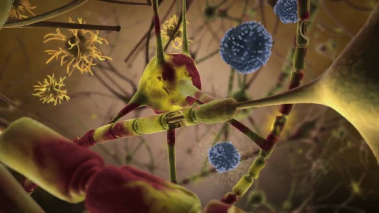 Autoimmune Diseases Are Triggered By Infection - But How? | Health And ...