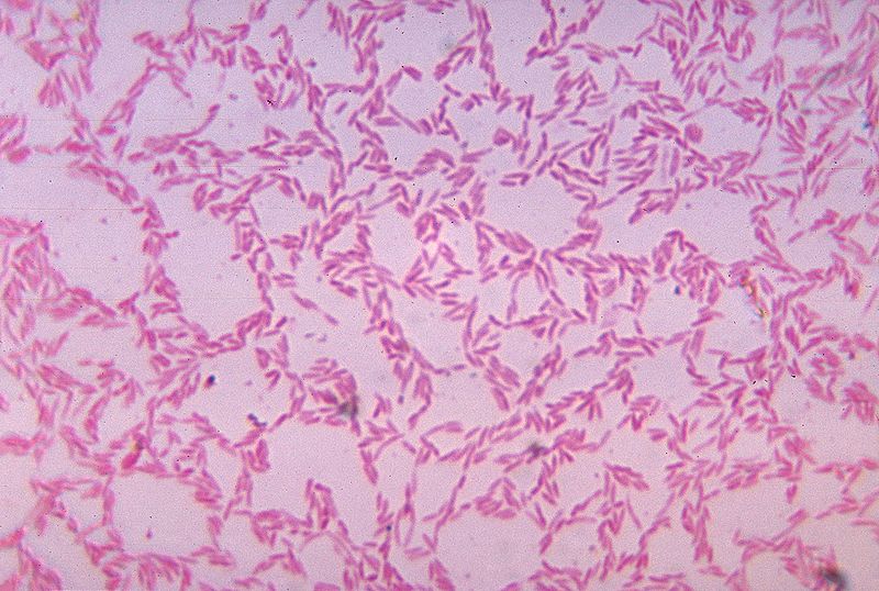 Bacteria in the Mouth Produce Fat Contributing to Heart Disease ...