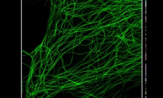 Marijuana-Induced Cyclic Vomiting | Cannabis Sciences