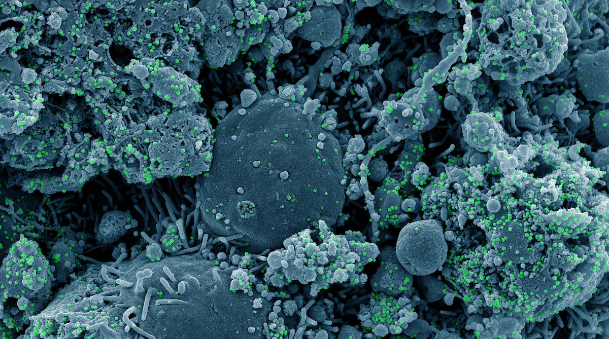 New Model Teaches Us More About Why the Delta Variant is So Infectious ...