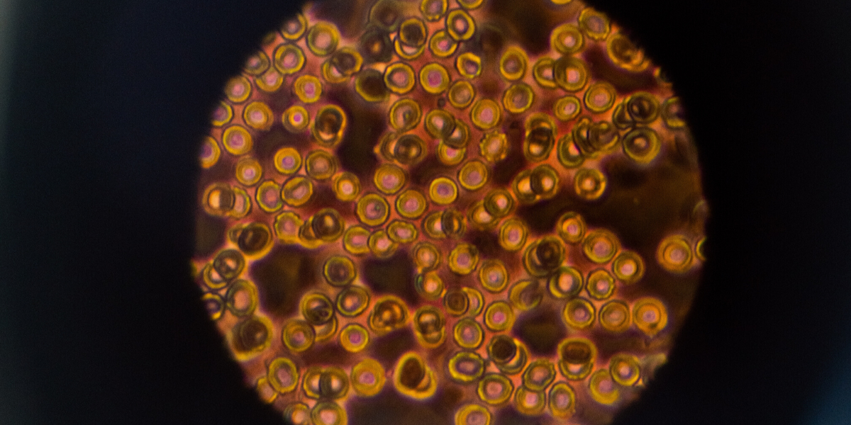 Cancer Cell Clusters Better At Resisting the Immune System | Immunology