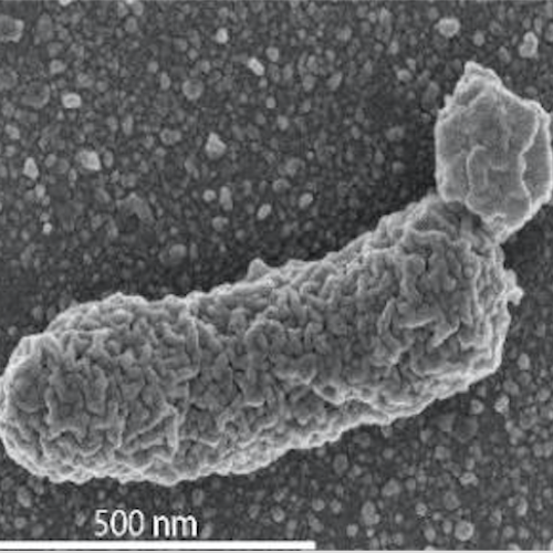 New Kind of Life Form Provides Insight Into Evolution | Microbiology