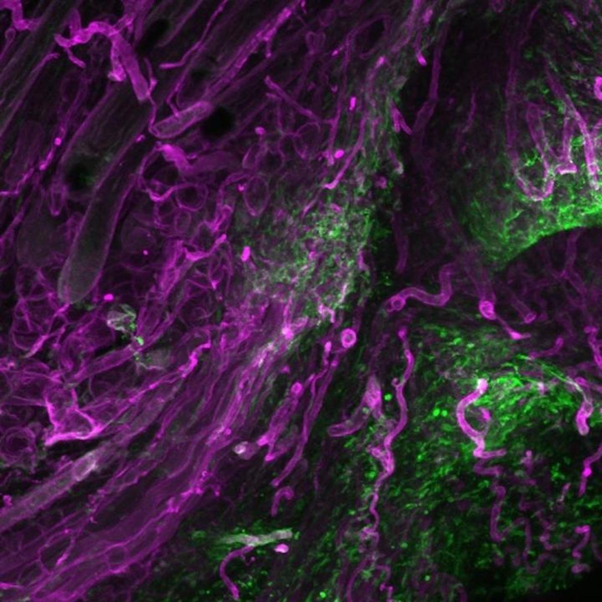 A New Understanding of How Scars Form | Cell And Molecular Biology