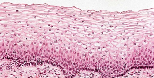 Epithelial Cells | | Content Tag