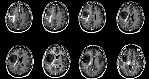 Mobile Brain Imaging (MoBI) | Virtual Events