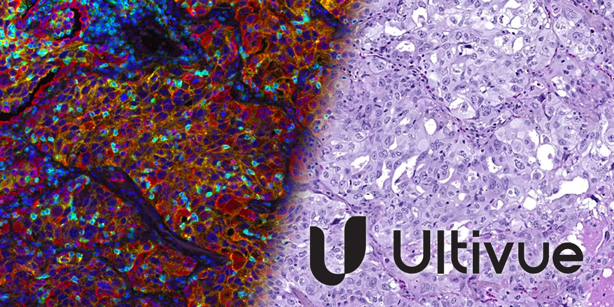 Understanding immune activation and evasion in the tumor ...