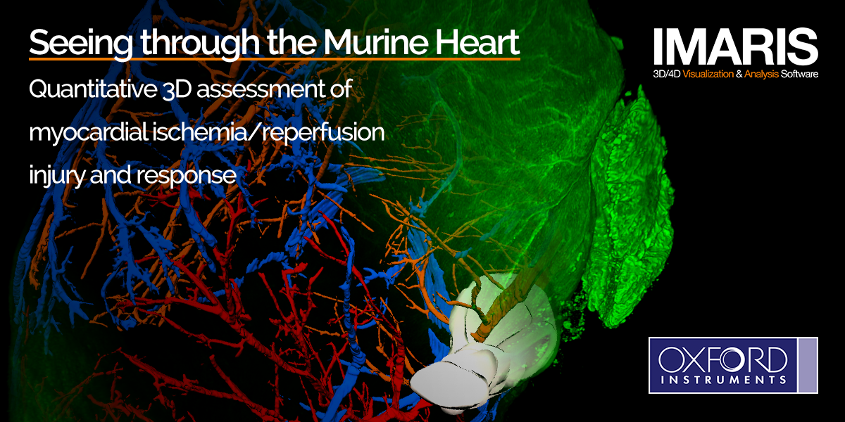Seeing through the murine heart - quantitative 3D assessment of ...