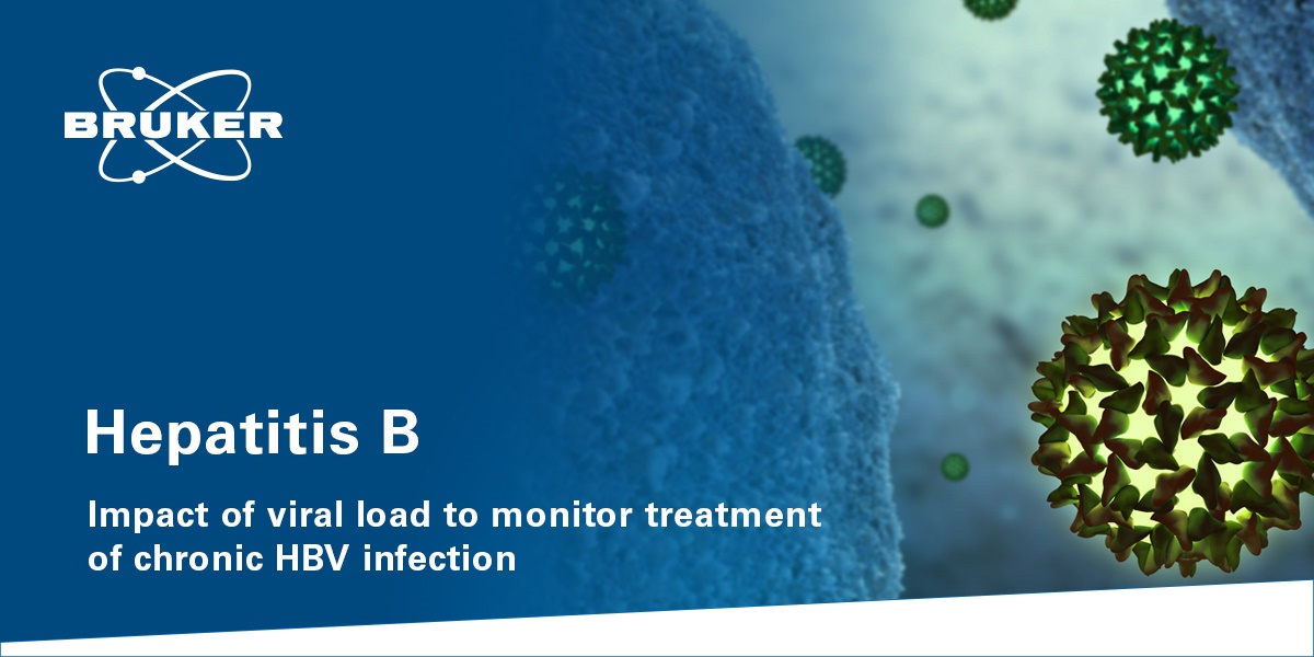 Importance of Hepatitis B viral load to trigger and monitor antiviral ...