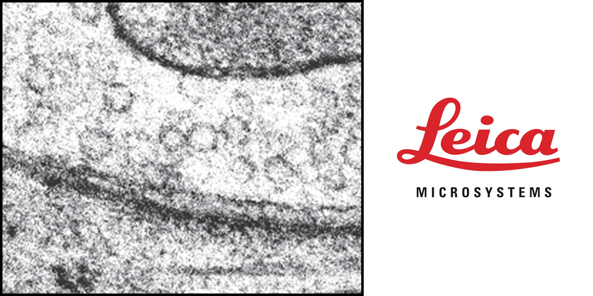 Time-resolved electron microscopy: synaptic ultrastructure millisecond ...