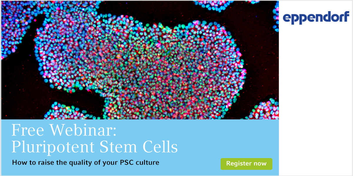 Pluripotent stem cells: How to raise the quality of your PSC culture