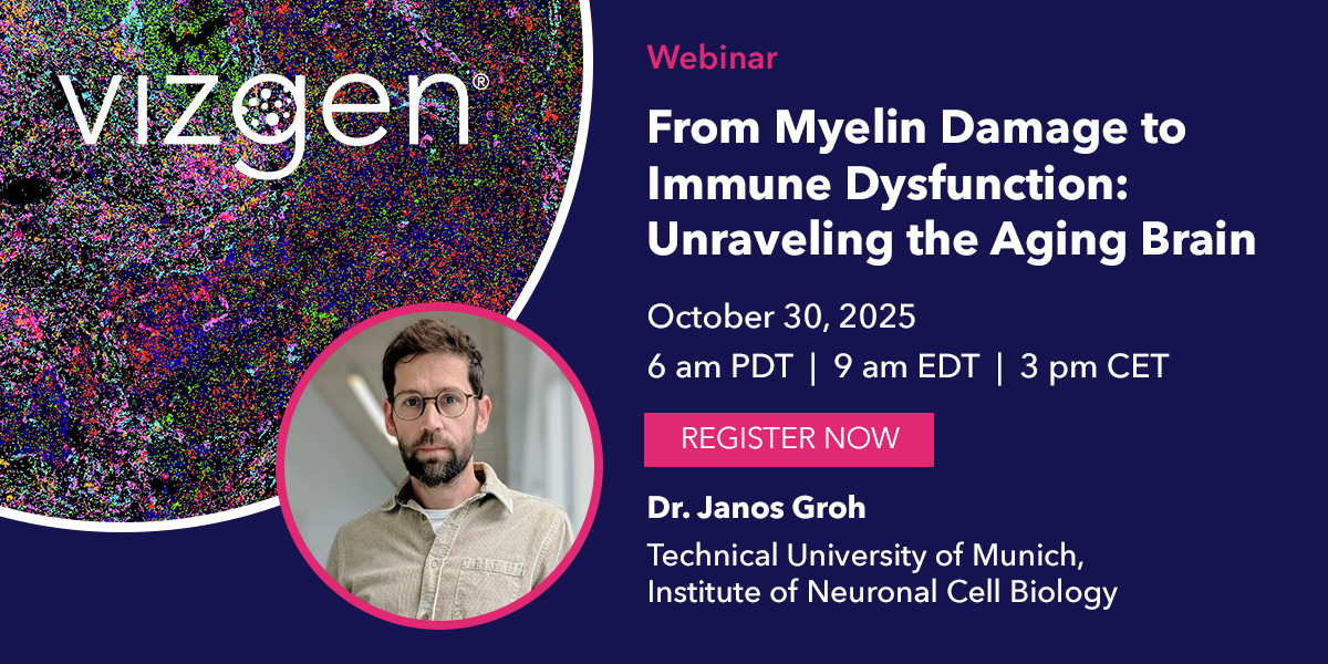 From Myelin Damage to Immune Dysfunction: Unraveling the Aging Brain