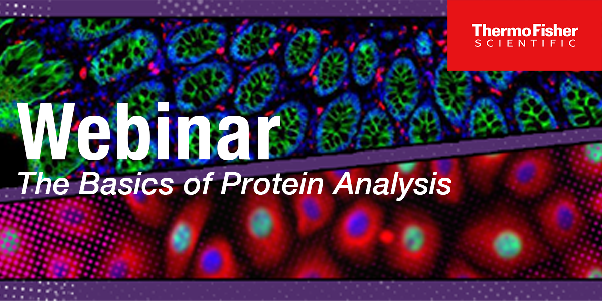 The Basics of Protein Analysis Topic 1: Fundamental of antibodies for ...