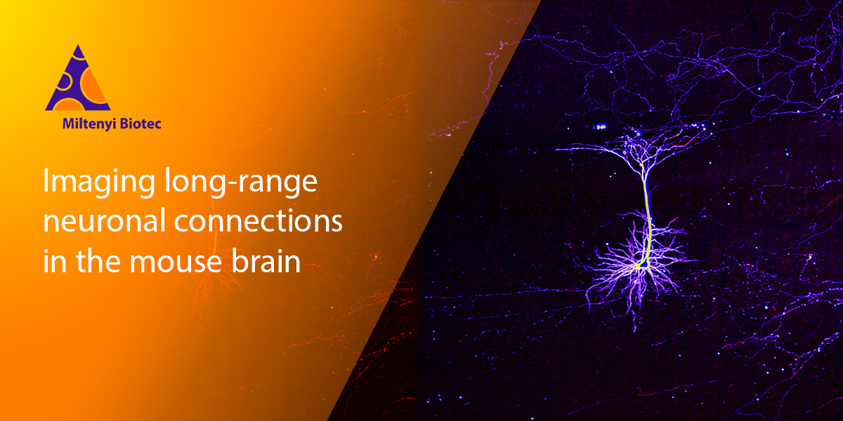 Imaging long-range neuronal connections in the mouse brain by light ...