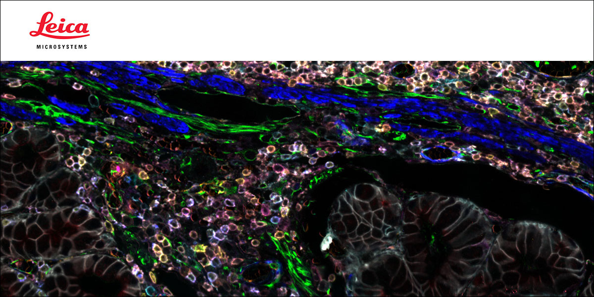 Study design: How and when to use multiplexed immunofluorescence ...