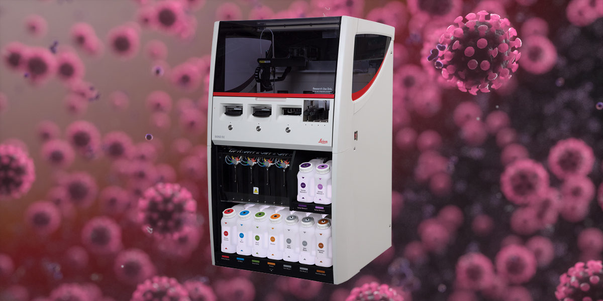 Incorporation and automation of RNAscope technology into your COVID-19 ...