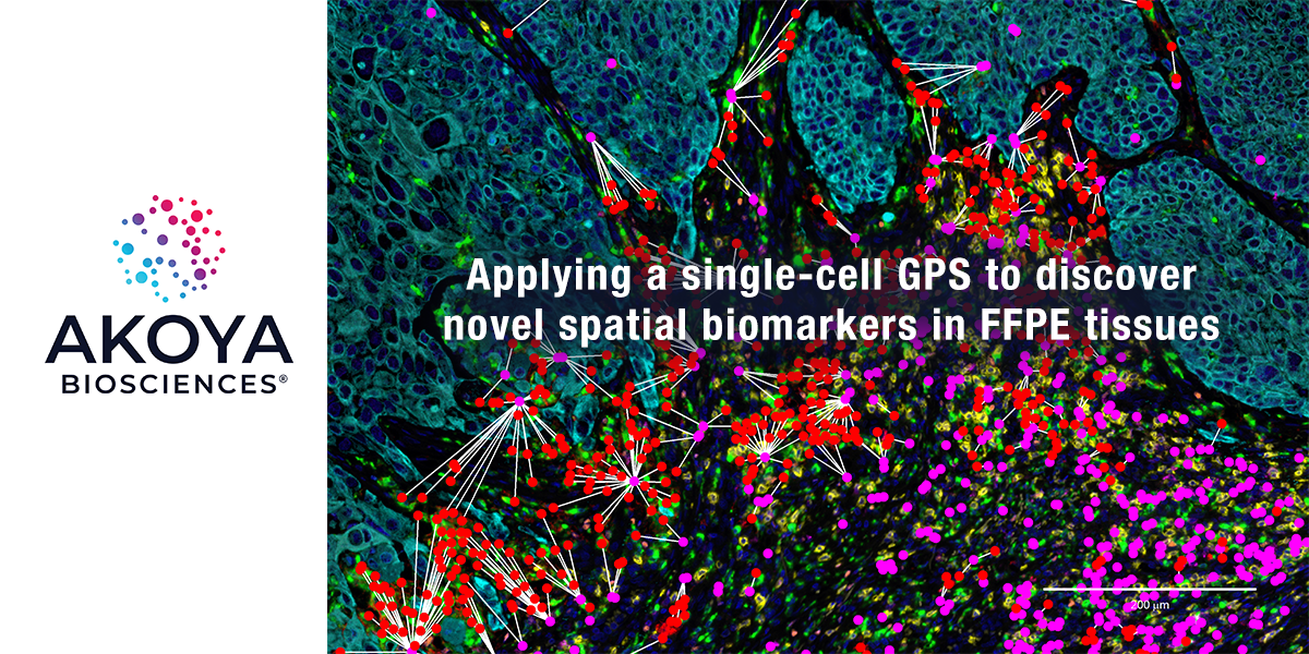 Applying a single-cell GPS to discover novel spatial biomarkers in FFPE ...