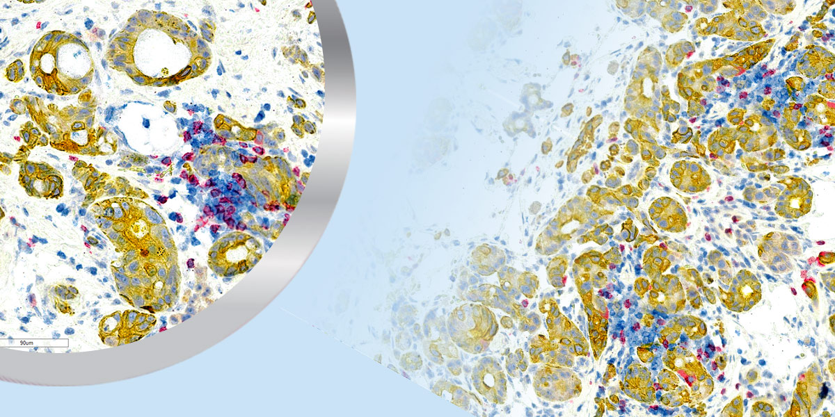 UltraPlex Multiplex Technology: Tagging Technology for Mouse and Human ...