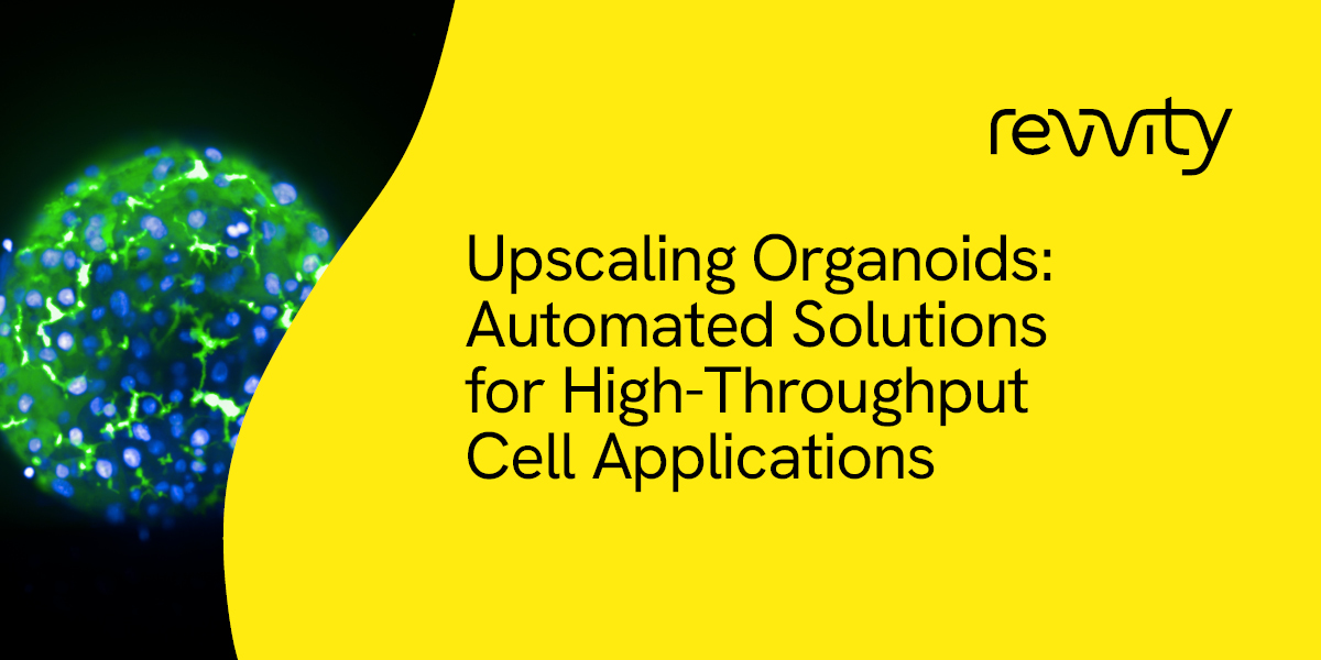 Upscaling Organoids: Automated solutions for high throughput cell ...