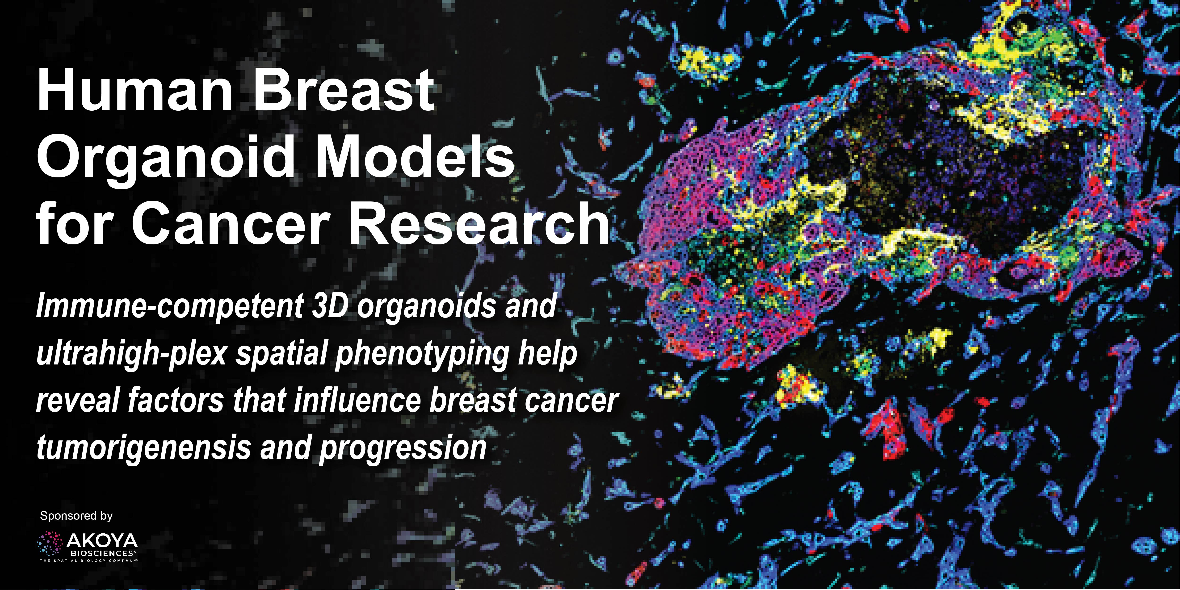 Human Breast Organoid Models for Cancer Research