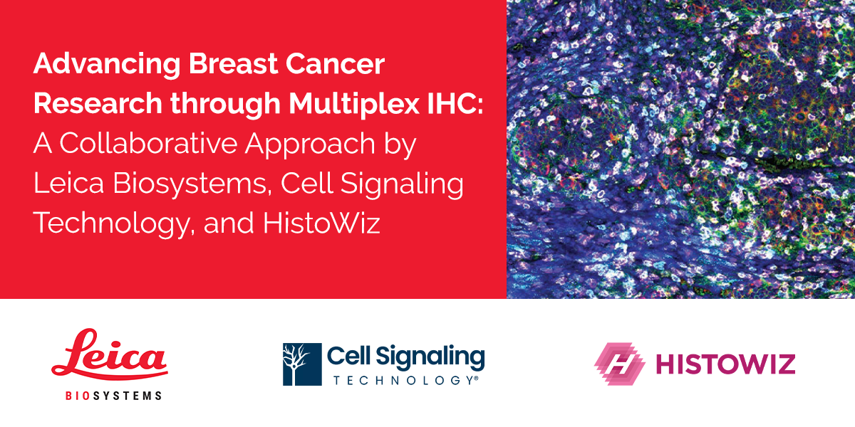 Advancing Breast Cancer Research through Multiplex IHC: A Collaborative Approach by Leica ...