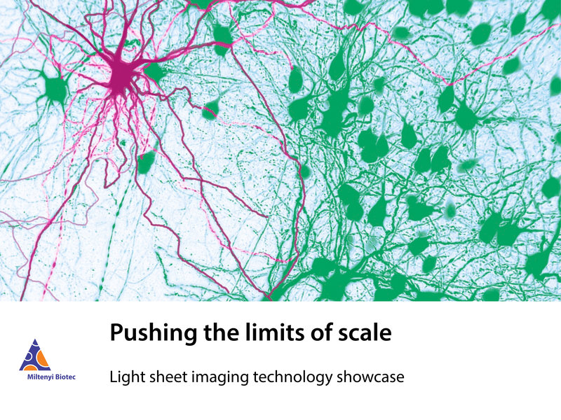 From Complex Social Behavior to Whole Brain Light Sheet Microscopy