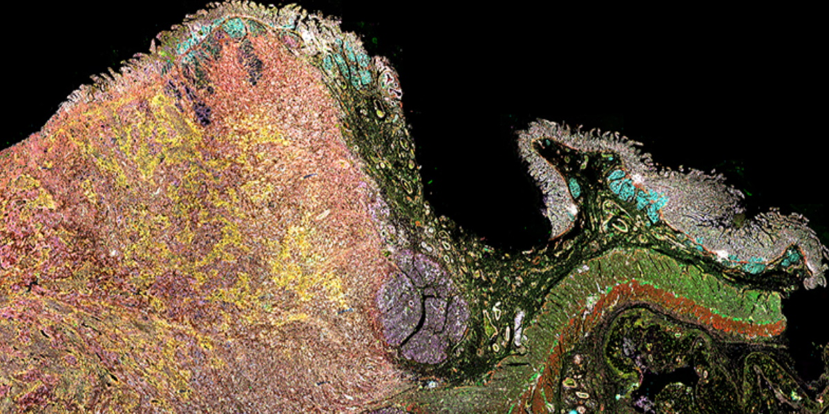 Cell Dive Transforming Tissue Research With Open Multiplexing