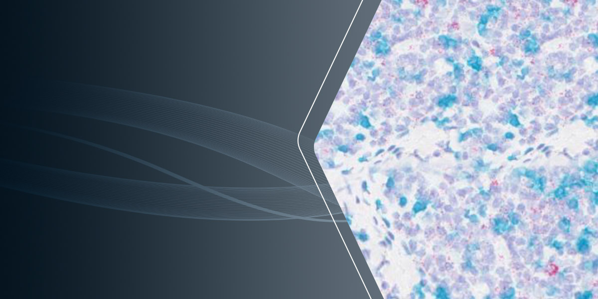 Combining RNAscope™ Technology with Protein Detection: A Multi Omics ...