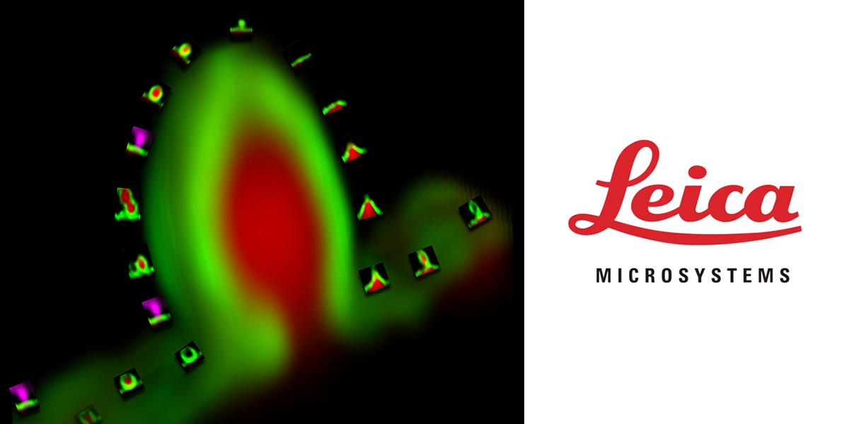 Visualizing membrane transformation in Live Cell with STED: Fusion and ...