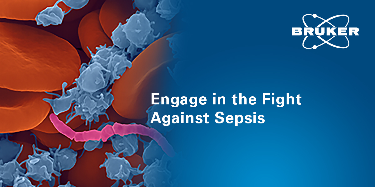 Performance comparison of Bruker MBT Sepsityper® Kit US IVD for culture ...